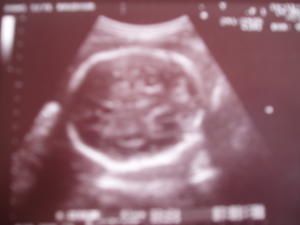 du foetus au nourrisson.....33 semaines - le blog chaquegrossesseestunique