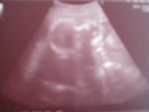 du foetus au nourrisson.....26 semaines - le blog chaquegrossesseestunique