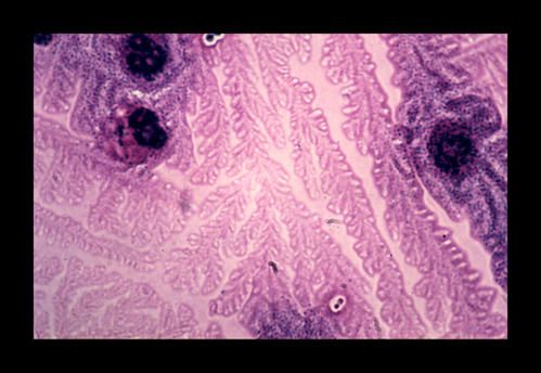 Liquide céphalo-rachidien - Examens directs ou portraits des bactéries