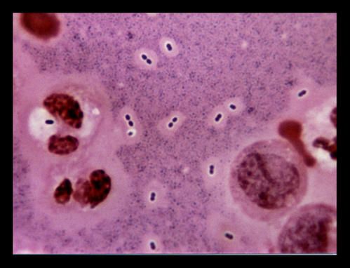 Prélèvements de l'appareil respiratoire - Examens directs ou portraits ...