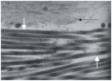 Le derme et l'hypoderme - La Biopsie Cutanée