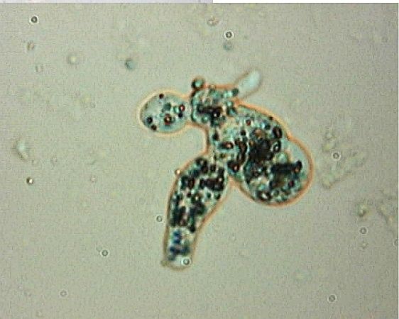 Habitants microscopiques de nos mares : l'Amibe - Micromegas, le blog d ...