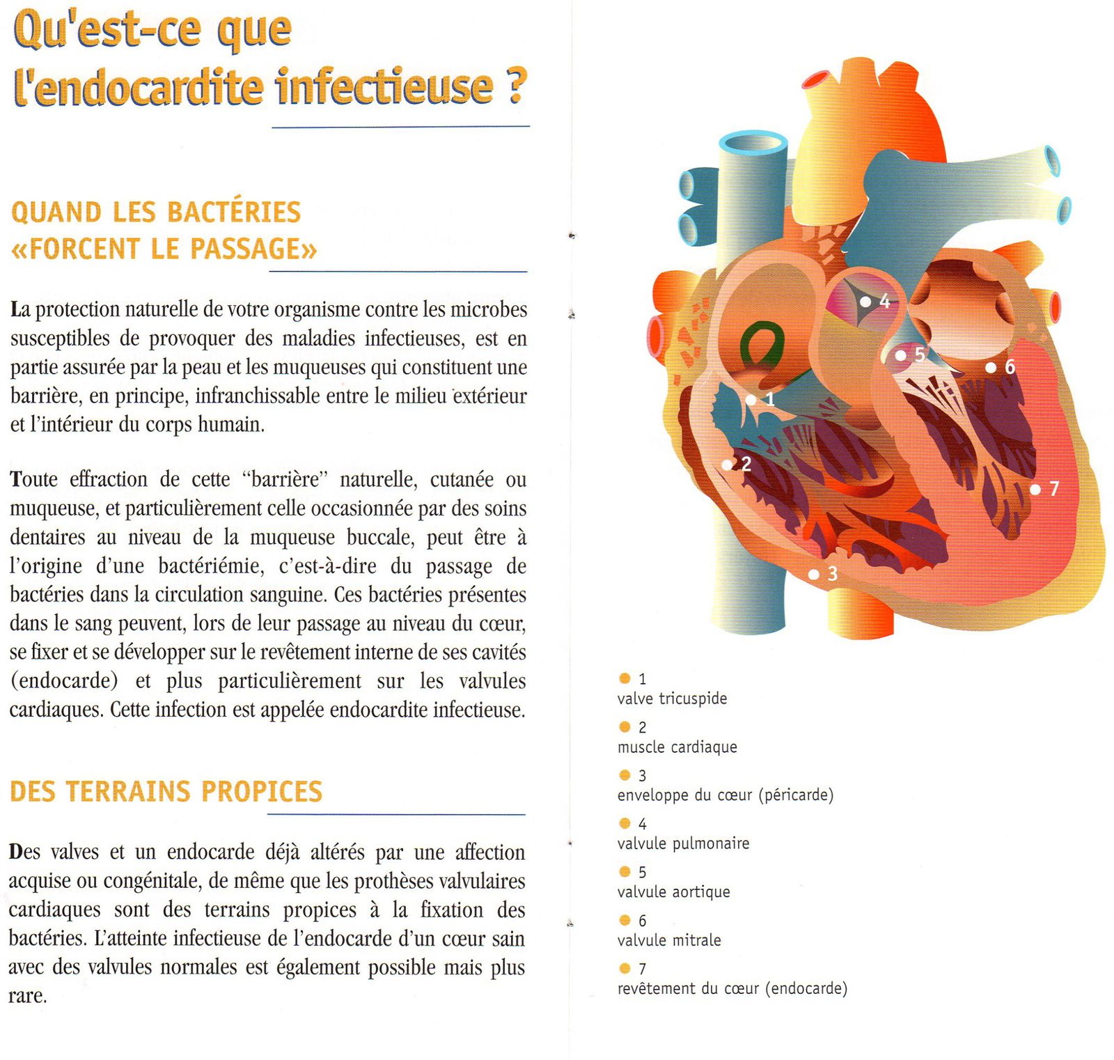 Endocardite infectieuse - INTERVENTION DE BENTALL
