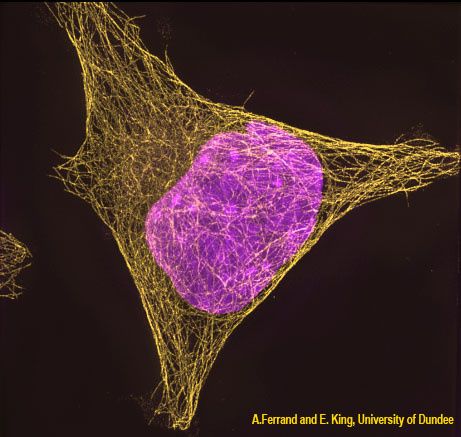 OMX, microscope a super resolution - Le blog de af-microscopy.over-blog.com